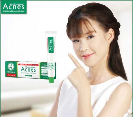 Kem Trị Mụn Acnes Giá Bao Nhiêu? Dùng Tốt Không? [Reviews]