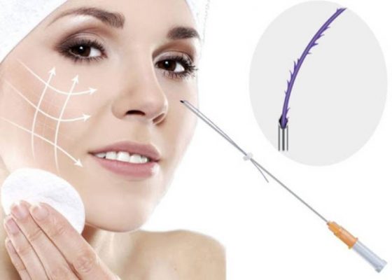 Cánh Mũi To Và Dày Làm Sao Để Thu Gọn Lại Cho Đẹp?