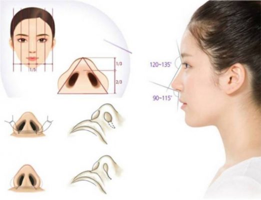 Cánh Mũi To Và Dày Làm Sao Để Thu Gọn Lại Cho Đẹp?