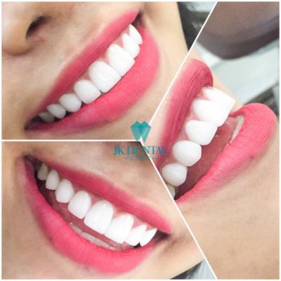 JK Dental - Nha Khoa Thẩm Mỹ Uy Tín Tại TPHCM Và Hà Nội